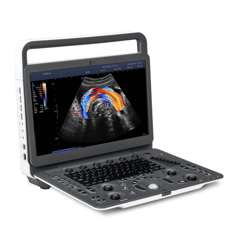 Sonoscape E2V ultrasound sonogram machine handheld potable animal ...