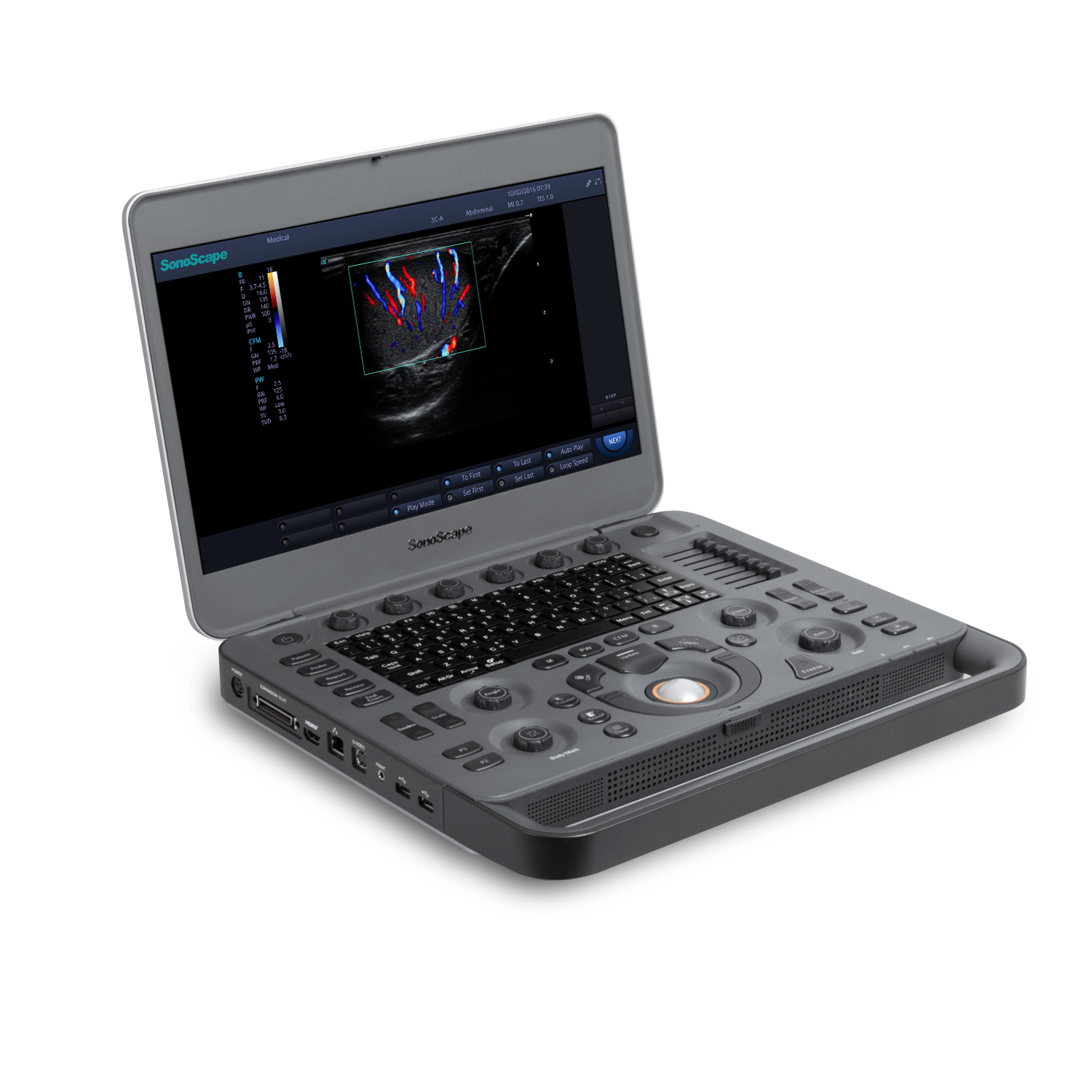 Sonoscape X5 Ultrasound Portable Color Doppler Ultrasound Machine For Sale